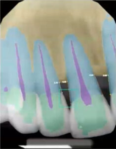 ThriveCloud Cloud-Based Dental Software